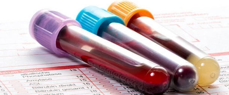 White Blood Cells (WBCs): Natural Ways to Increase WBC Count - High ...