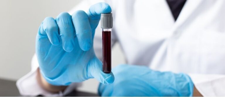 Prolactin: Test, normal ranges, results, high vs low - High Rated Gabru