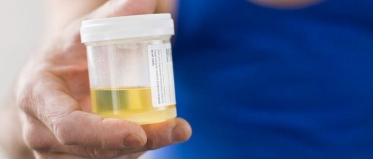 Foamy urine: Causes, symptoms, prevention, treatments and diet - High ...